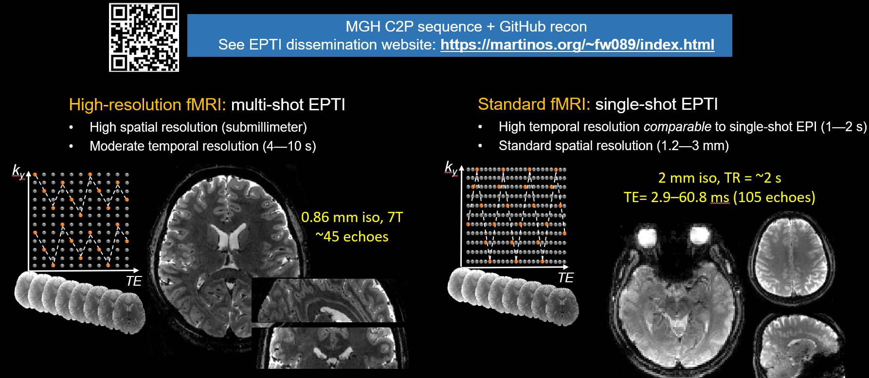 Resources - Advanced MRI Acquisition Lab
